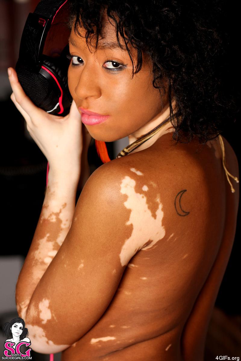 Vitiligo Headphones Starway